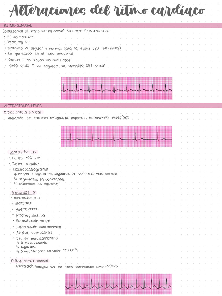 Disrritmias (1) | PDF | Enfermedades y trastornos | Especialidades Medicas