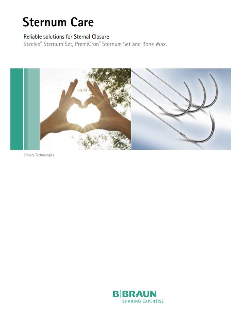 Steelex Sternum Set | PDF