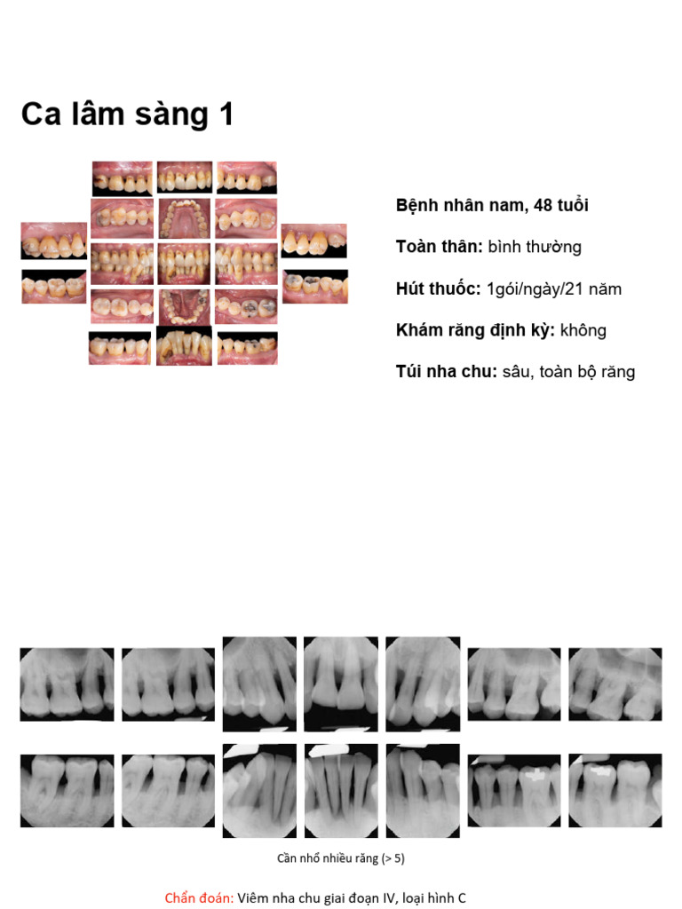 CA Lam Sang Lap KHDT Nhom 4 | PDF