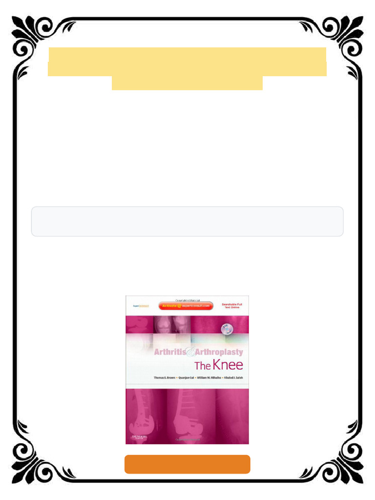 Arthritis and Arthroplasty The Knee 1 Har/DVD/ Edition Thomas E. Brown ...