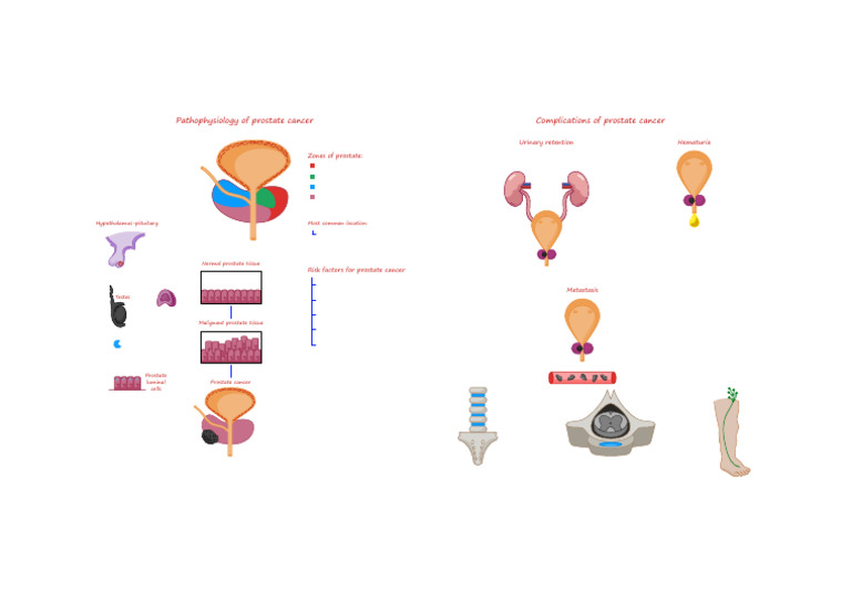 ONC-05 - Prostate Cancer (Illustrations - Handout) | PDF