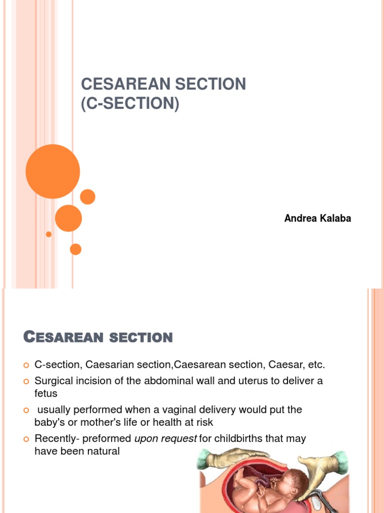 Understanding Cesarean Sections: History, Procedure, and Risks | PDF ...