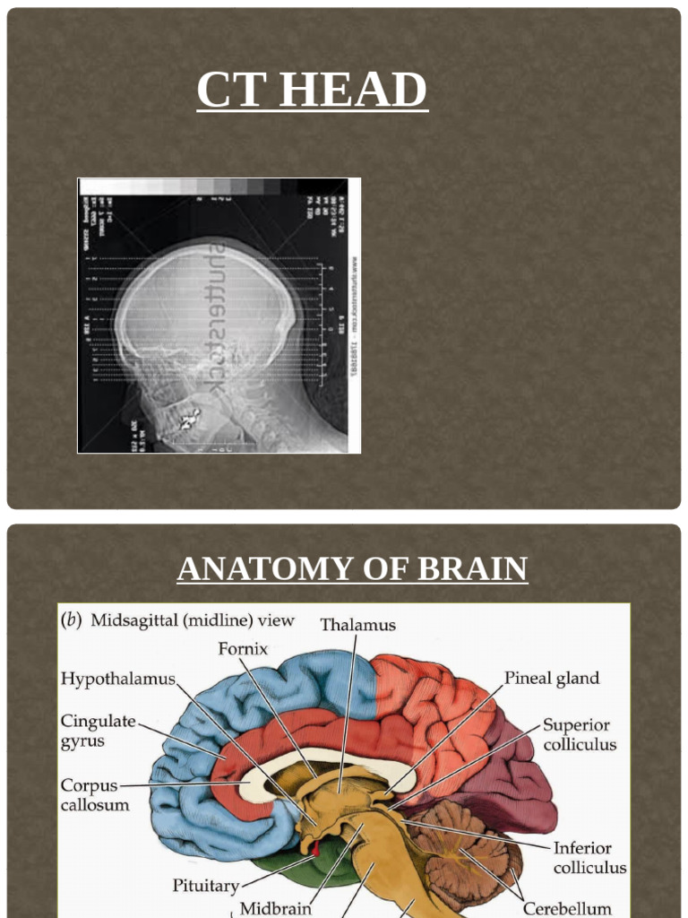 CT Head Scan Protocol Overview | PDF