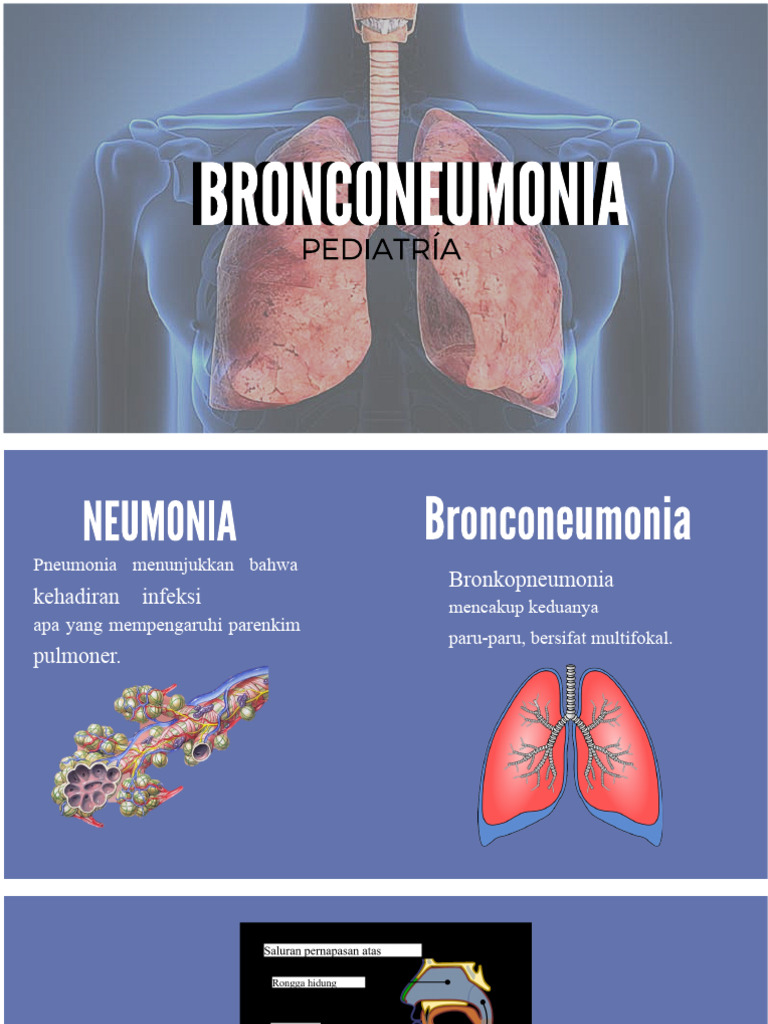 BRONKOPNEUMONIA | PDF
