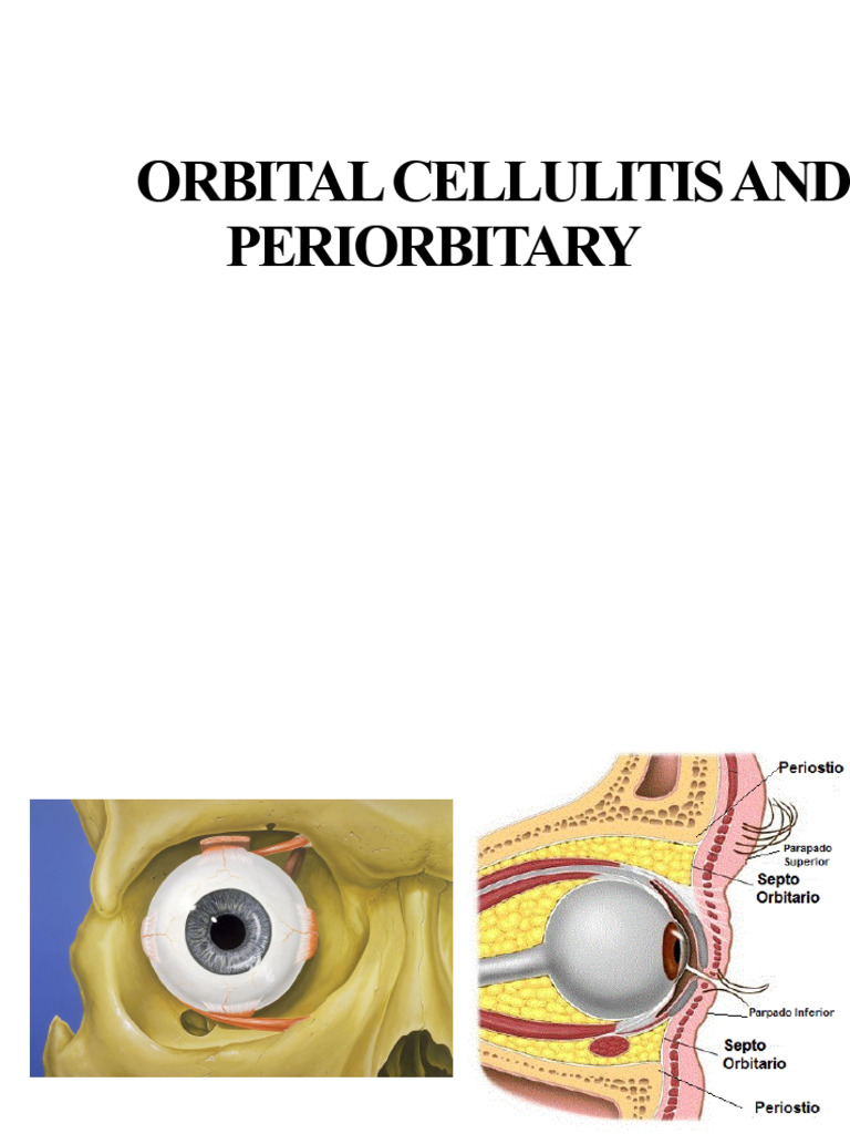 Orbital and Periorbital Cellulitis | PDF | Medical Specialties | Immunology