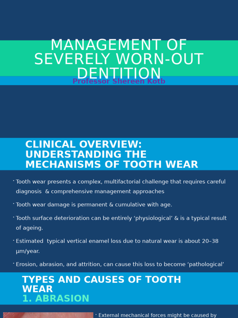 Managing Severe Tooth Wear Issues | PDF | Human Tooth | Dental Anatomy