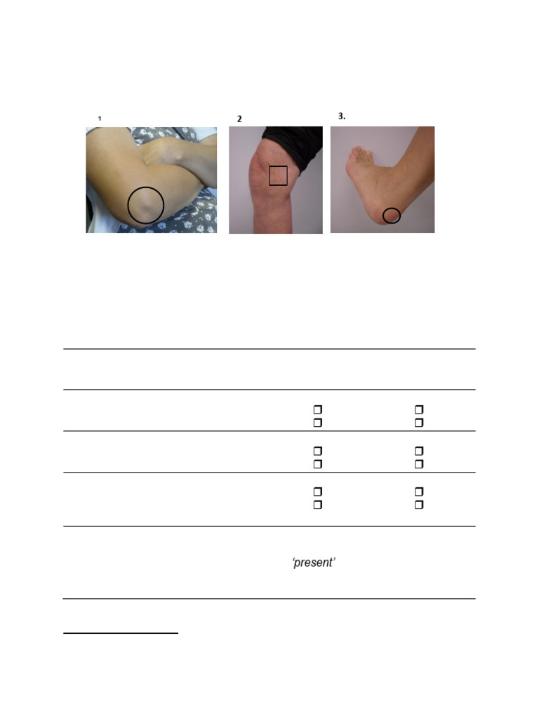 Leeds Enthesitis Index: Site Pain/Tenderness Absent Pain/Tenderness ...