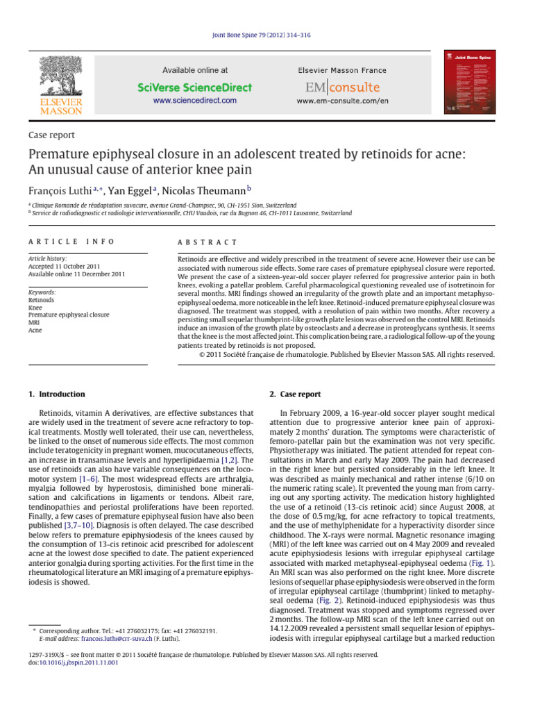 Premature Epiphyseal Closure in an Adolescent Treated by Retinoids for ...