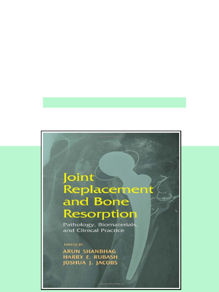 (Ebook) Joint Replacement and Bone Resorption: Patholo Biomaterials and ...