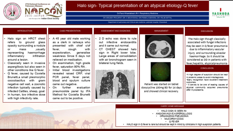 Q Fever | PDF | Pneumonia | Medicine