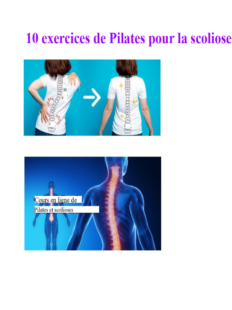10 Exercices de Pilates pour Scoliose | PDF | Méthode Pilates | Scoliose