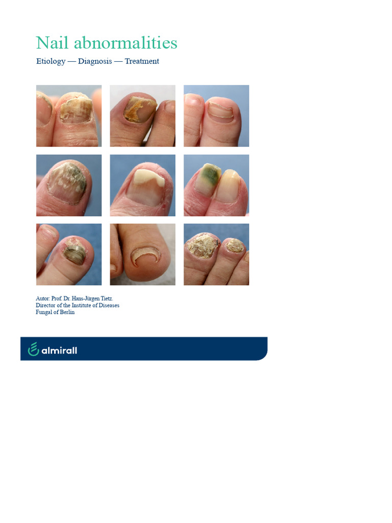 Understanding Nail Abnormalities | PDF | Infection | Nail (Anatomy)