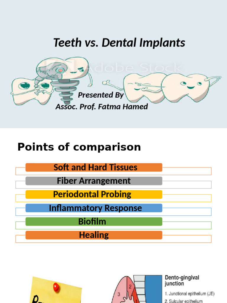 Perio Tooth Vs Implant 1 | PDF | Periodontology | Bone