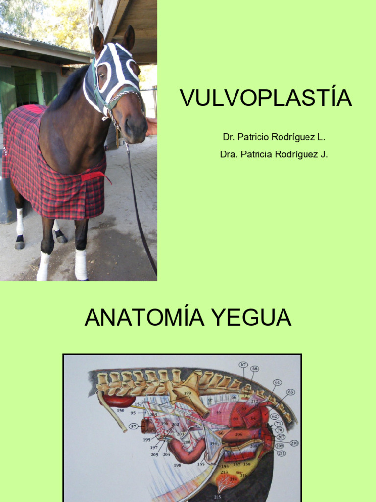 VULVOPLASTÍA | PDF