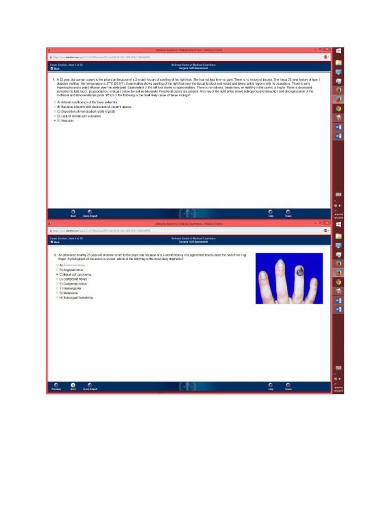 Surgery NBME 1 Wrong | PDF