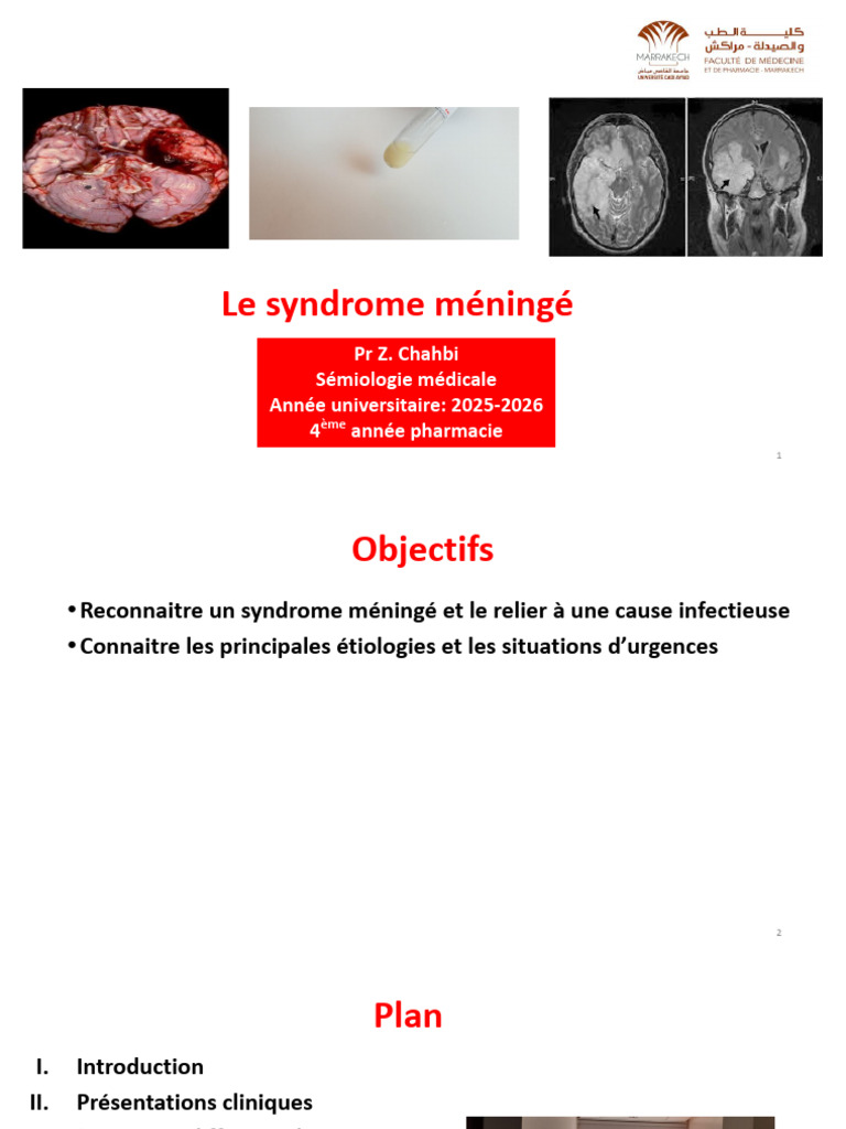 Comprendre le syndrome méningé | PDF | Maladies et troubles humains ...