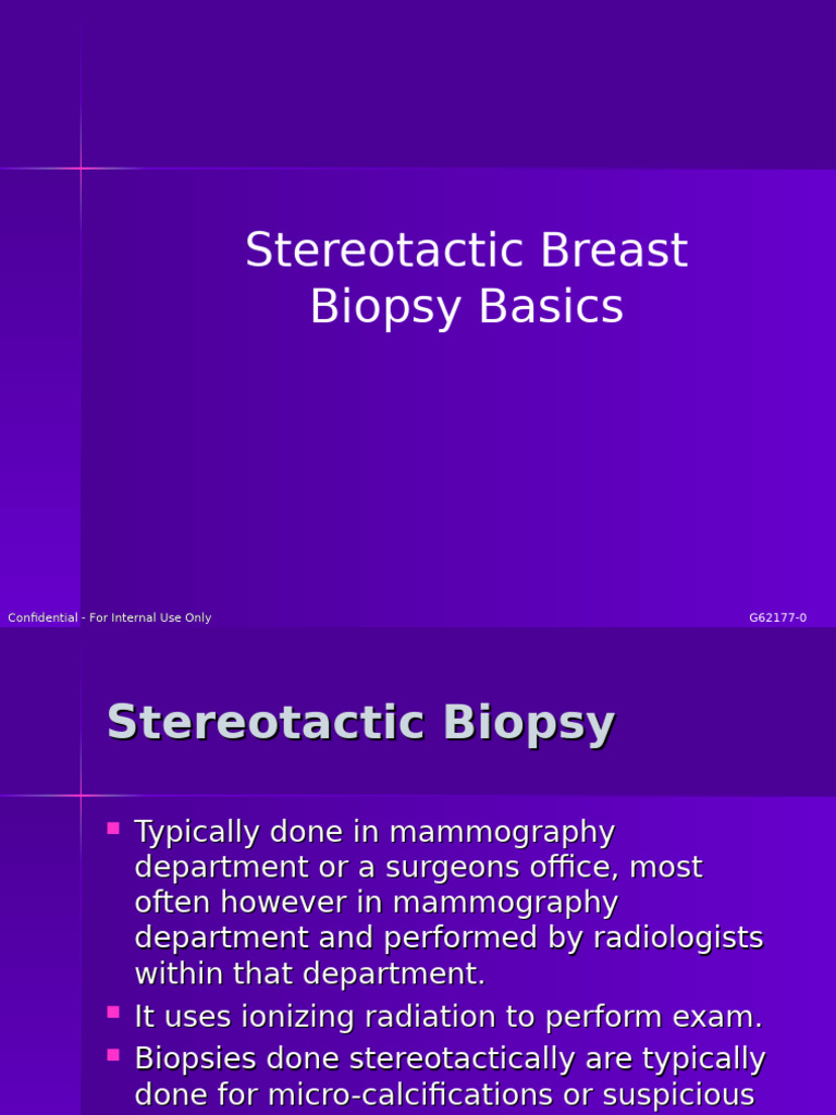 Stereotactic Breast Biopsy Overview | PDF | Mammography | Biopsy