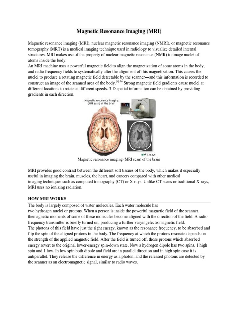 Magnetic Resonance Imaging (MRI) | PDF | Magnetic Resonance Imaging ...