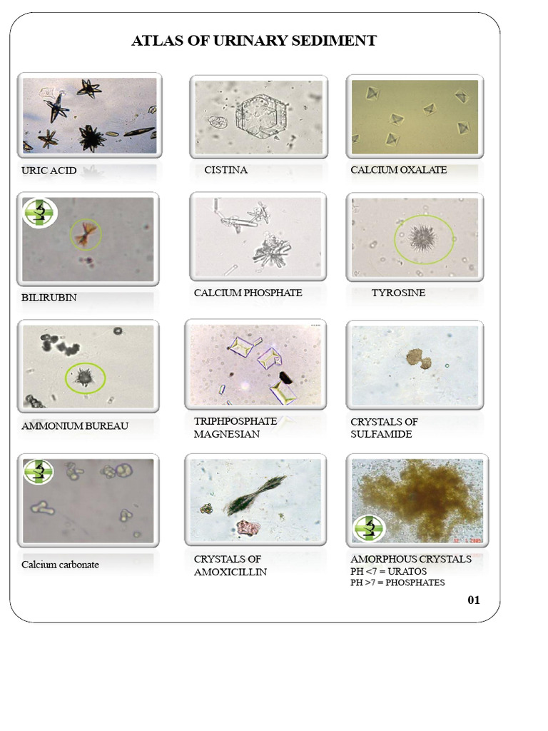 Atlas of Urinary Sediment PDF | PDF