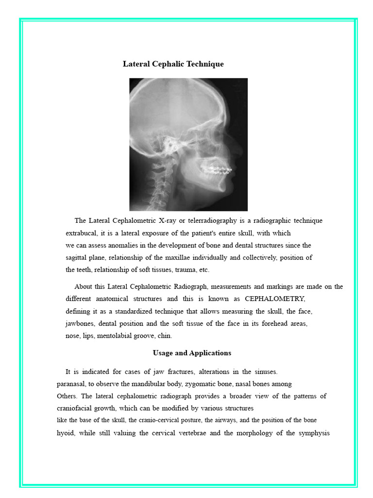 Lateral Cephalometric X-ray Guide | PDF | Dental Anatomy | Human Anatomy