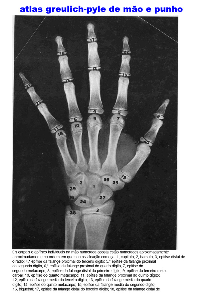 Atlas Greulich-Pyle: Idade Esquelética | PDF | Mão | Membros (anatomia)
