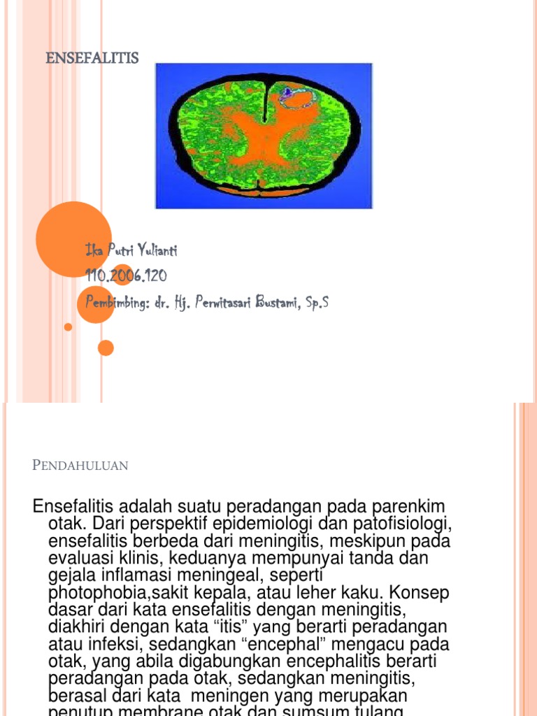 ENSEFALITIS | PDF