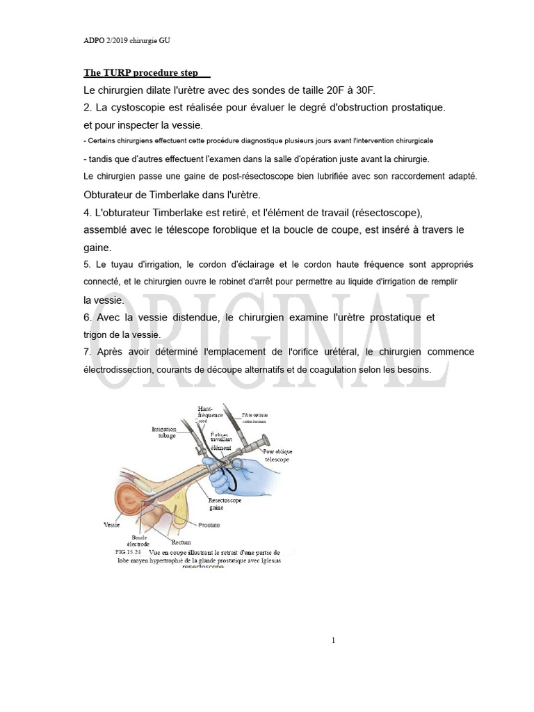 L'étape de la procédure TURP | PDF | Prostate | Spécialités médicales