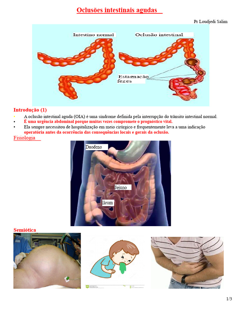 05-Oclusões Intestinais Agudas | PDF | Trato gastrointestinal ...