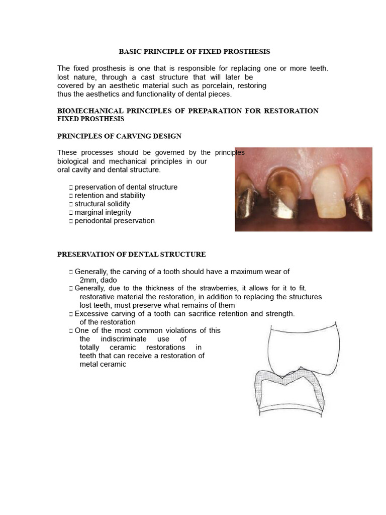Fixed Prosthesis Preparation Principles | PDF | Dentistry Branches ...