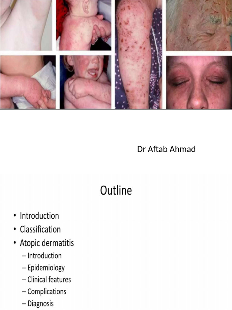 DR Aftab Ahmad | PDF