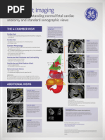 IVC Assessment in POCUS for Shock | PDF | Shock (Circulatory) | Human ...