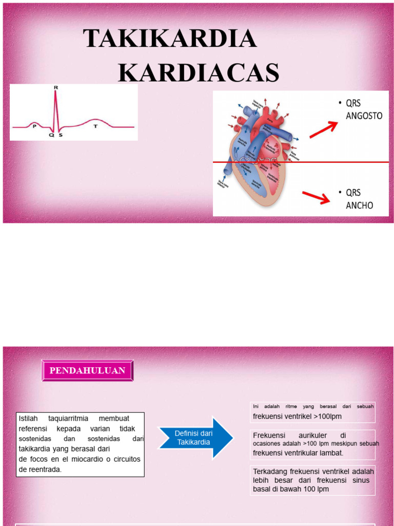 Panduan Lengkap Takikardia Jantung | PDF