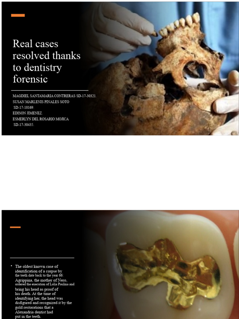 Forensic Dentistry: Historic Case Studies | PDF