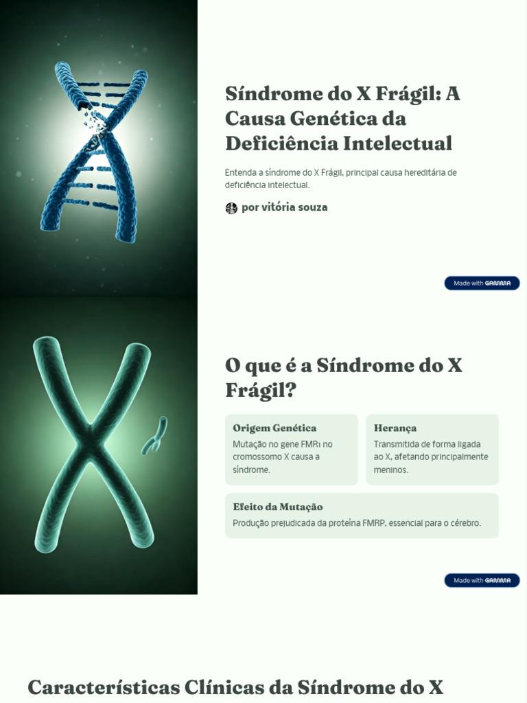 Síndrome do X Frágil: Causas e Tratamentos | PDF