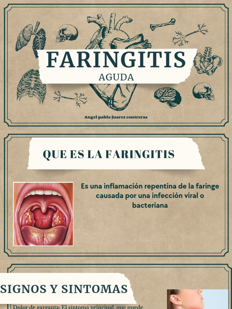 Faringitis Aguda | PDF | Enfermedades y trastornos humanos | Microbiología