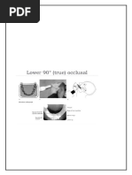 Occlusal Projections in Radiography | PDF | Anatomical Terms Of ...
