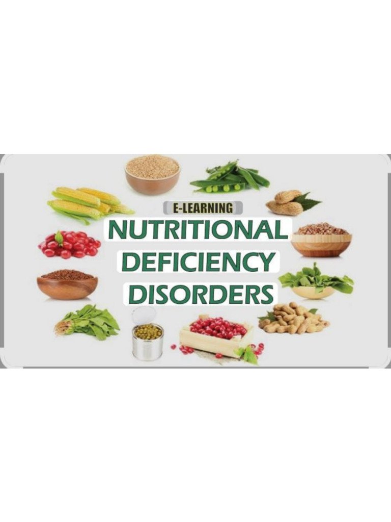 Nutritional Deficiency Disorders | PDF