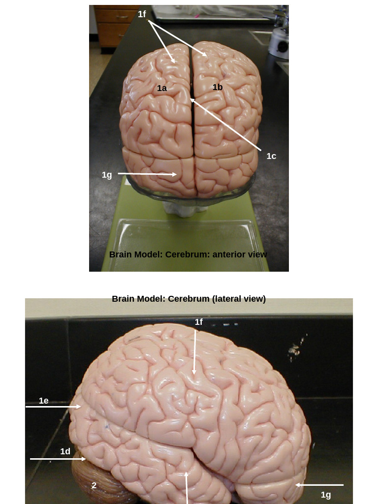 Brain and Spinal Cord Models (1) 2 | PDF | Anatomical Terms Of Location ...