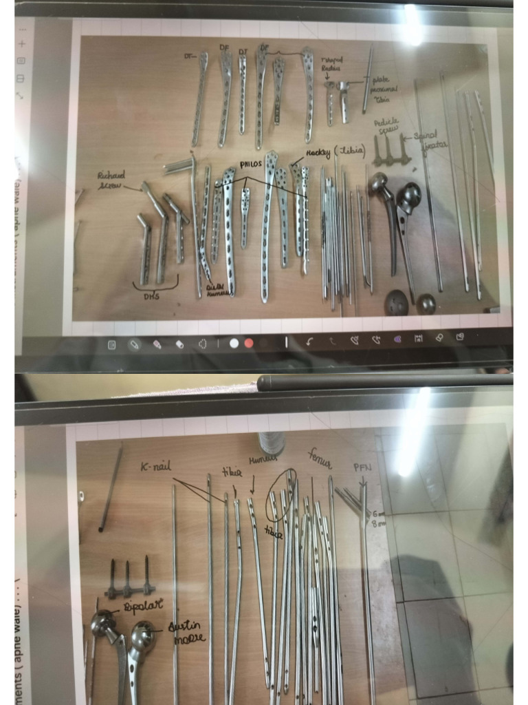 ortho instruments | PDF