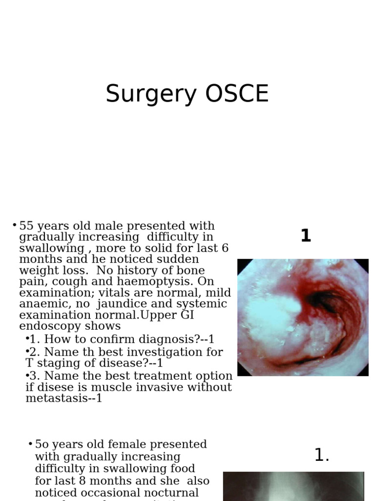 Student Surgery OSCE | PDF | Esophagus | Diseases And Disorders