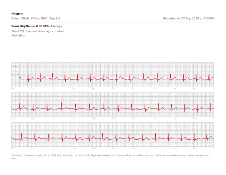 Health - Home - ECG 2025-09-27 at 16.30 | PDF