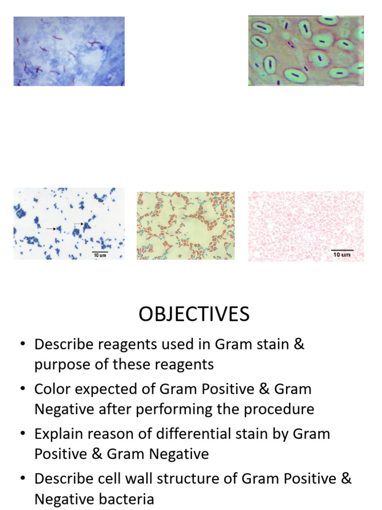Staining of Bacteria Gram Stain Acid Fast Stain 1 م.نور مثنى محمود ...