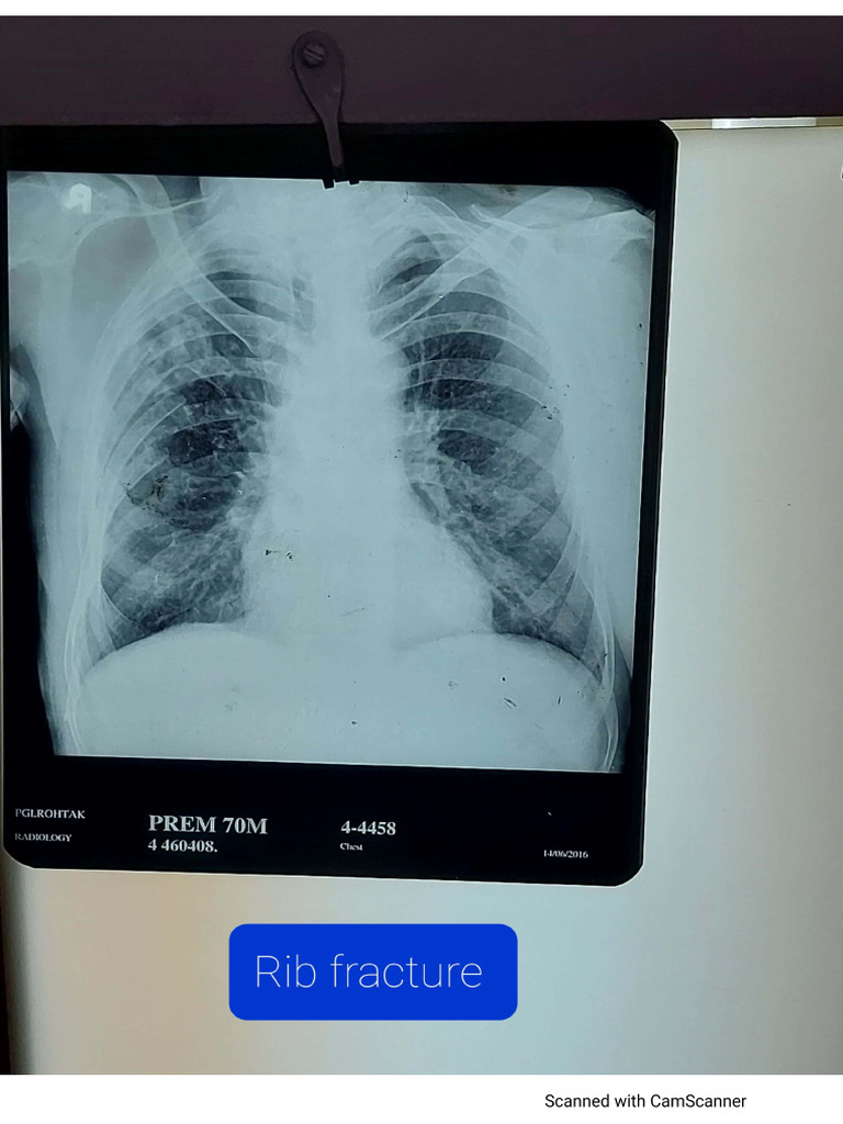 Surgery X Rays | PDF