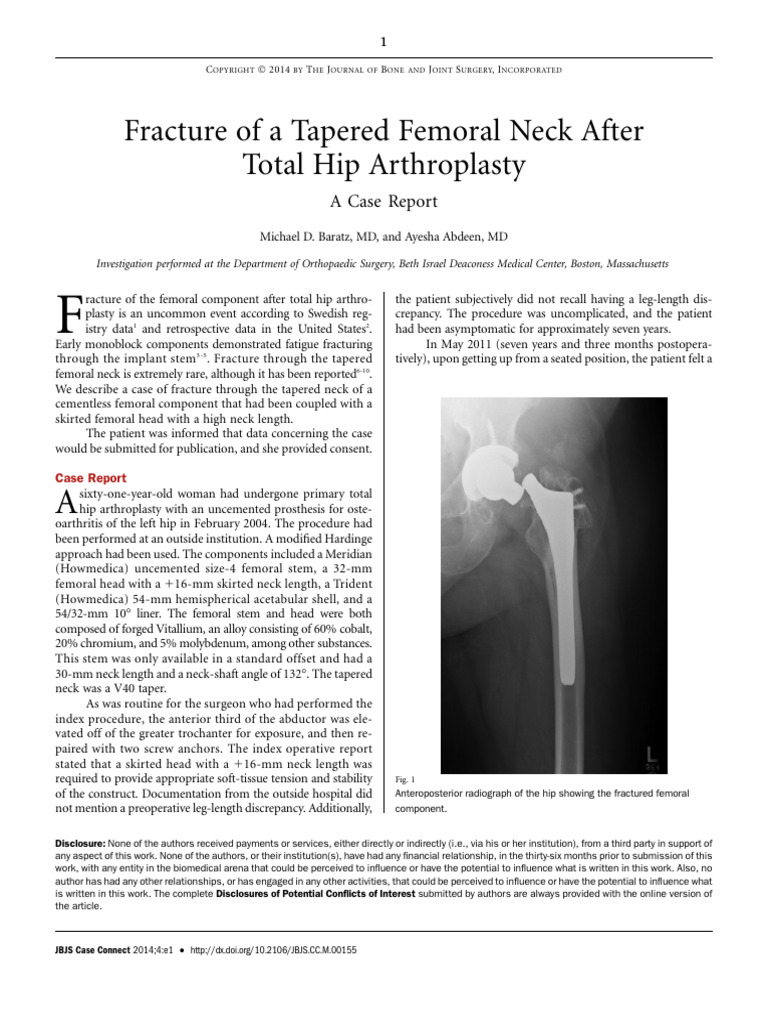 Tapered Femoral Neck Fracture Case Report | PDF | Hip