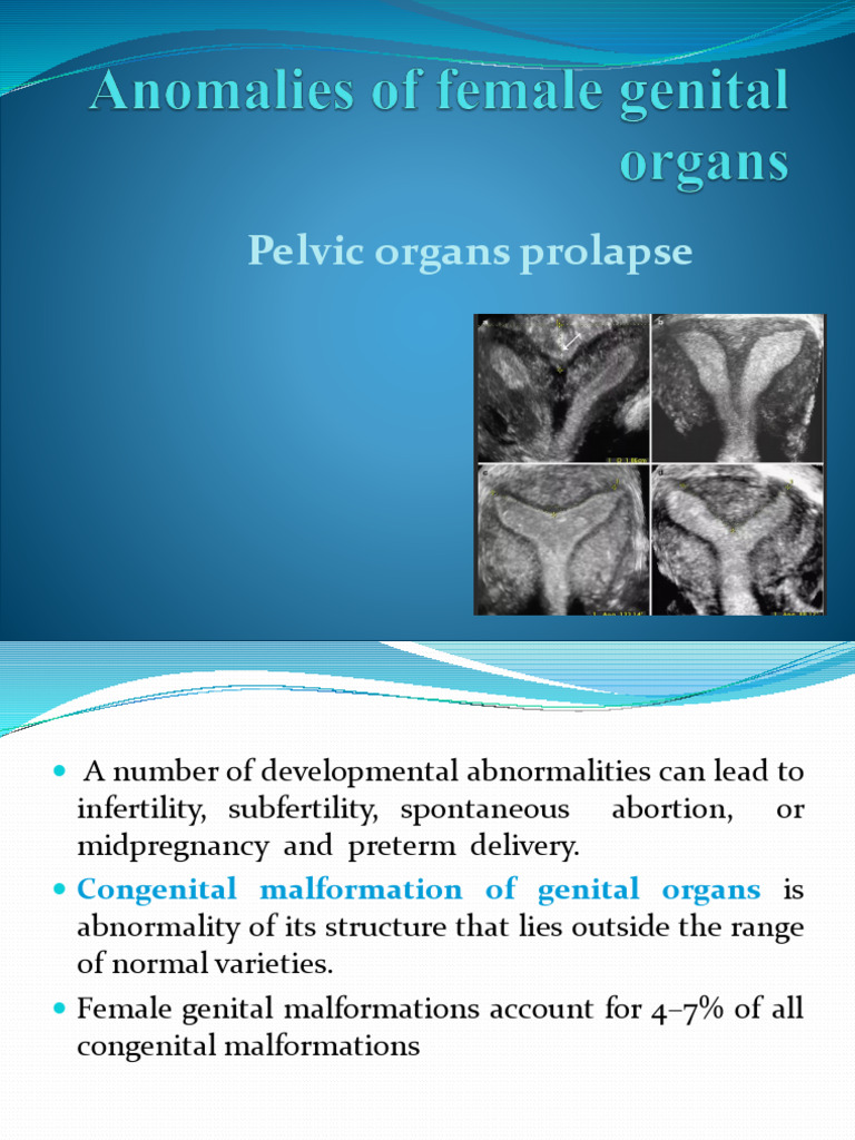 Anomalies of Female Genital Organs | PDF | Uterus | Vagina