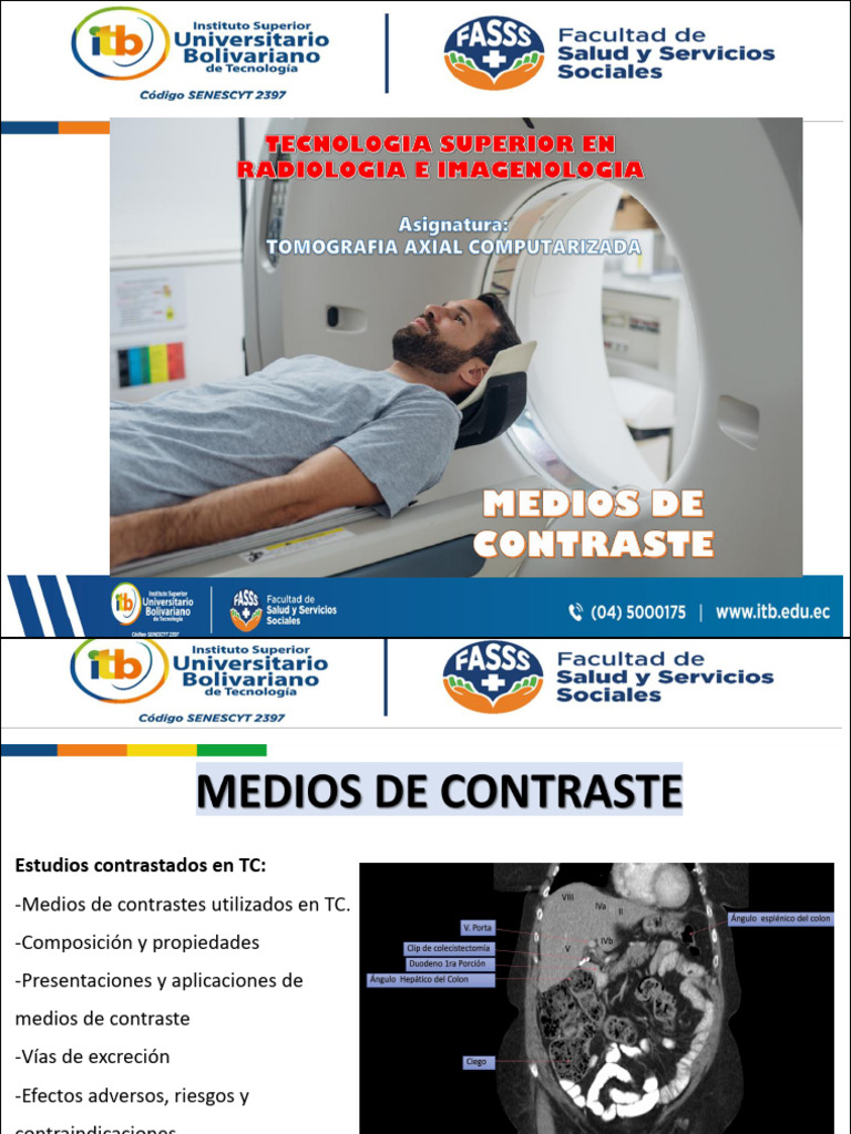 Medios de Contraste | PDF | Ct Scan | Sistema urinario