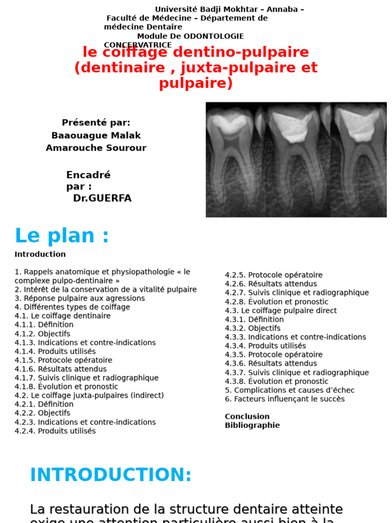 Coiffage dentino-pulpaire en odontologie | PDF | Dent humaine | Dent