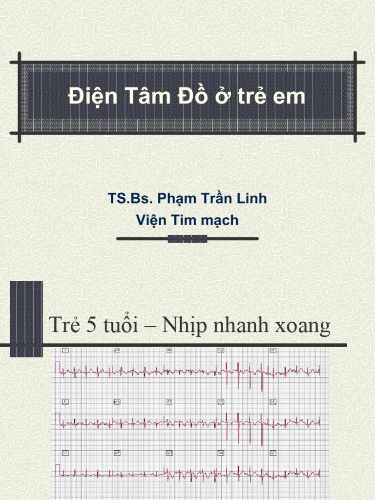 DTD tre em 2 | PDF