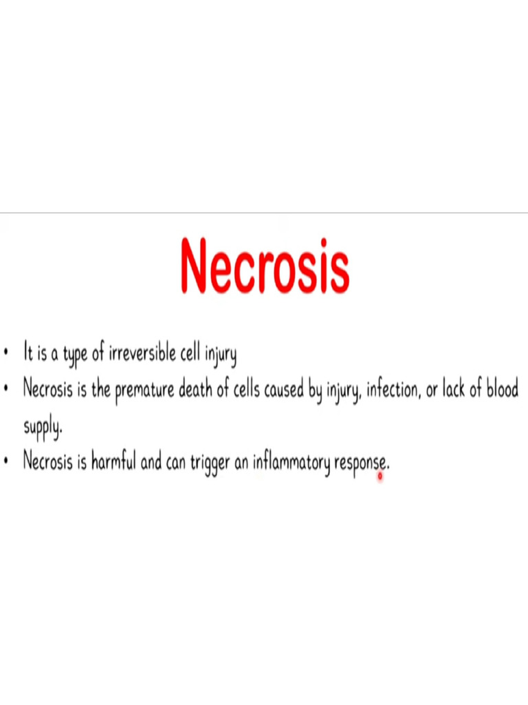 Necrosis MLT | PDF