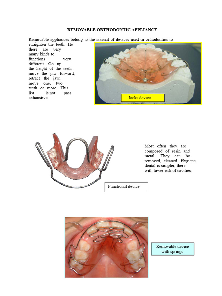 Removable Orthodontic Appliance | PDF